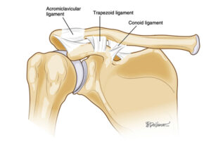 AC Joint Injuries - Zahab Ahsan, MD